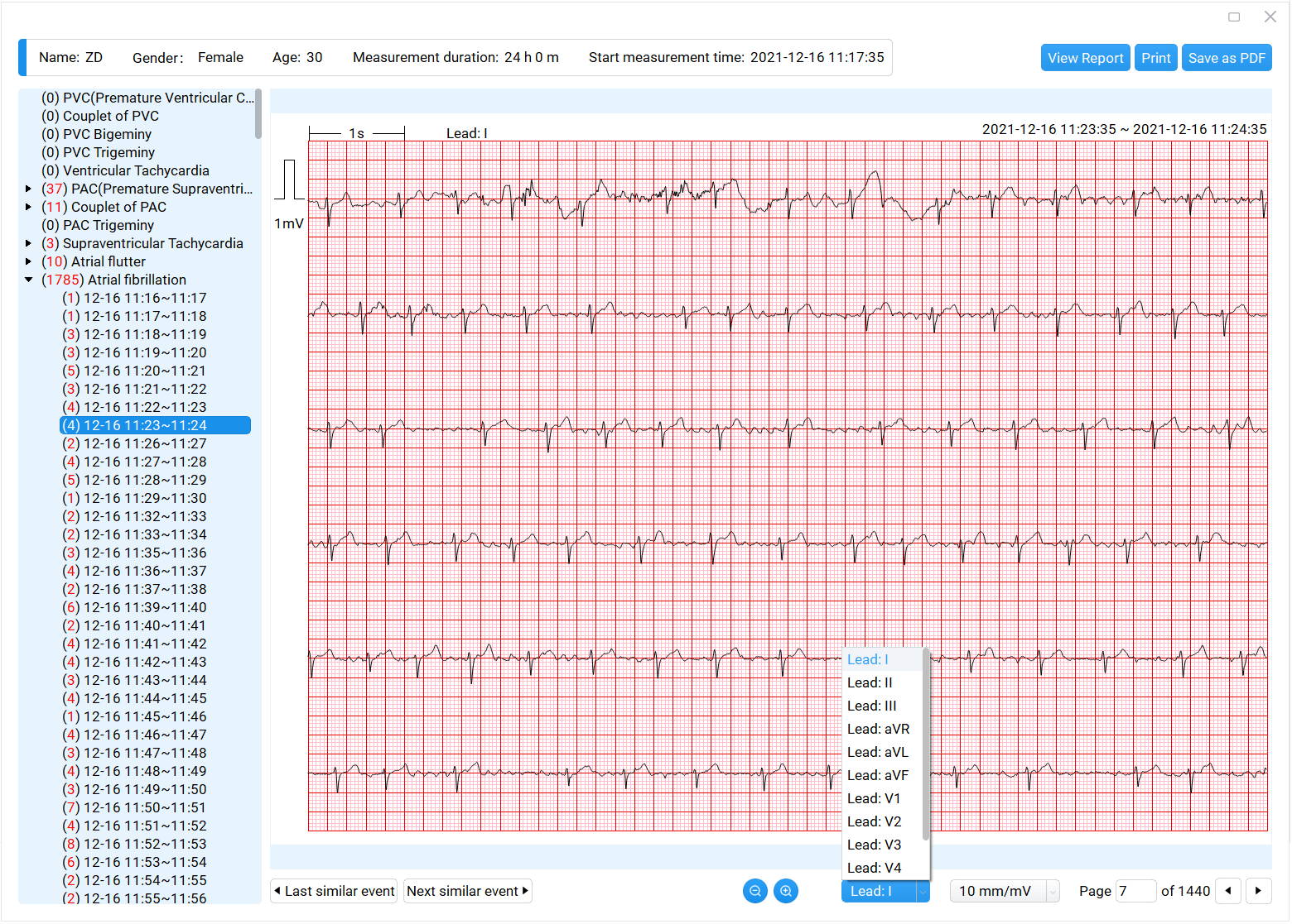 Help Center for AI-ECG Analysis System – Wellue